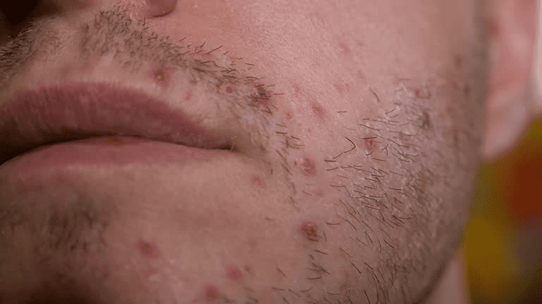 Derma Prime Plus Scam 2025: 8 Warning Signs Buyers Must See